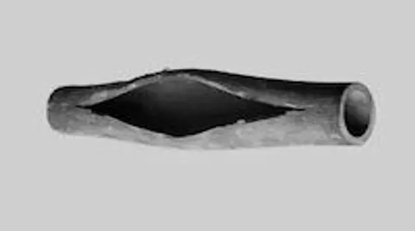 Analysis of Boiler Tube Failure Due to Burst | Landee