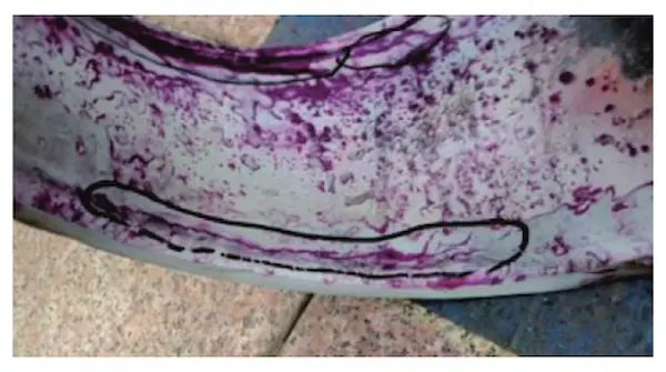 Failure Analysis of Surge Pipe Elbow in the Top Cover of a Large ...