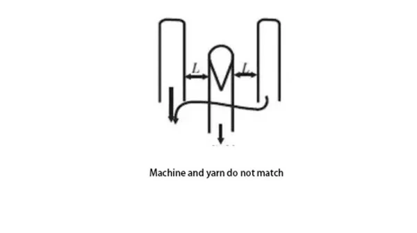 Common Causes of Fabric Breakage in Circular Knitting Machine Debugging ...